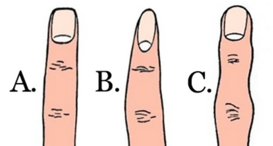 იცოდით რომ თქვენი ხასიათი თქვენი თითების ფორმაზეა დამოკიდებული აი მტკიცებულებაც რჩევები